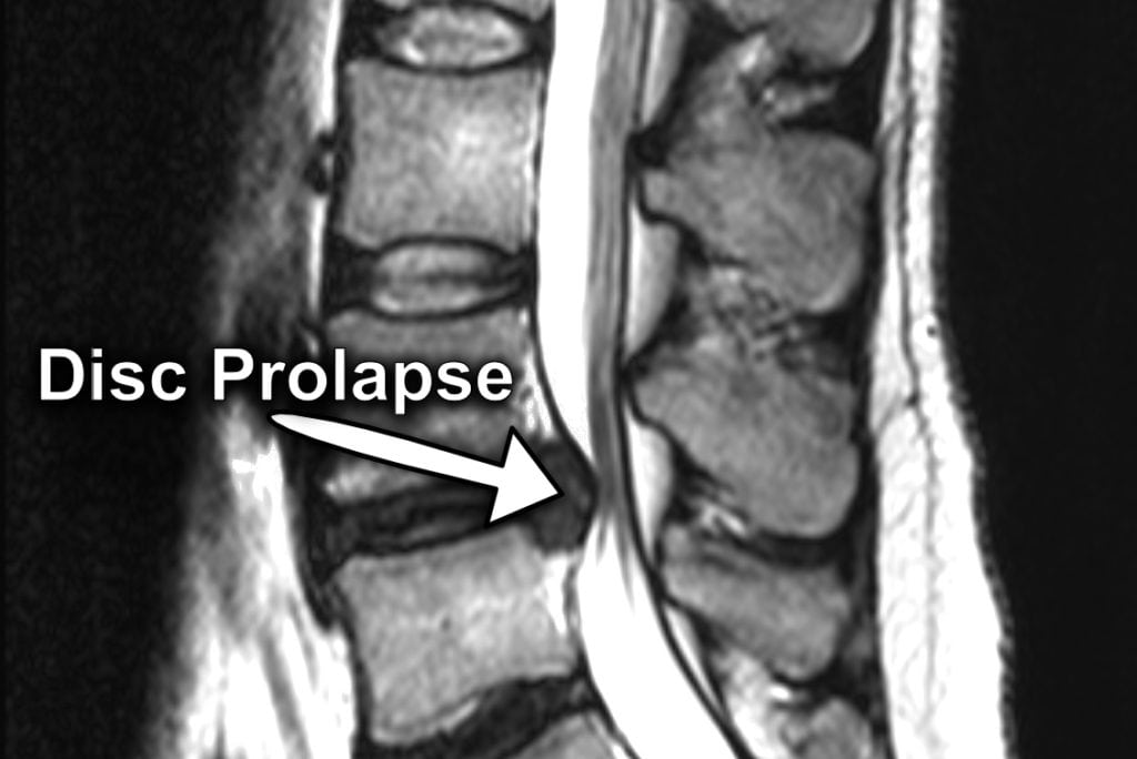 About Spine Plus Osteopath Clinics