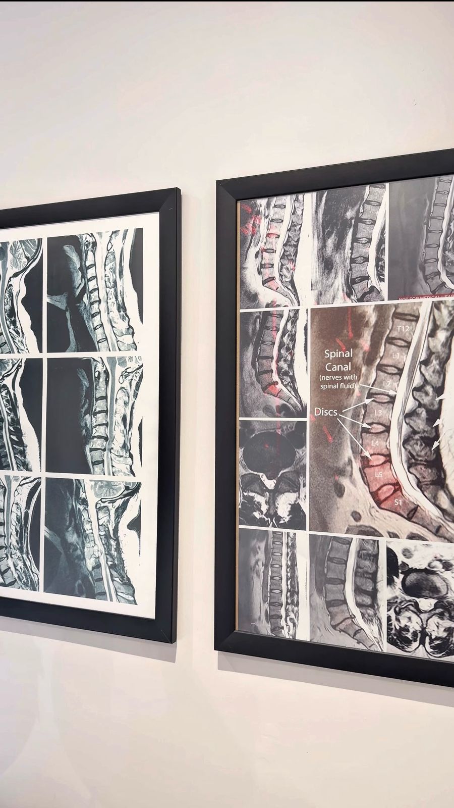 Hornchurch Osteopathy, Back Pain, IDD Clinic | Spine Plus